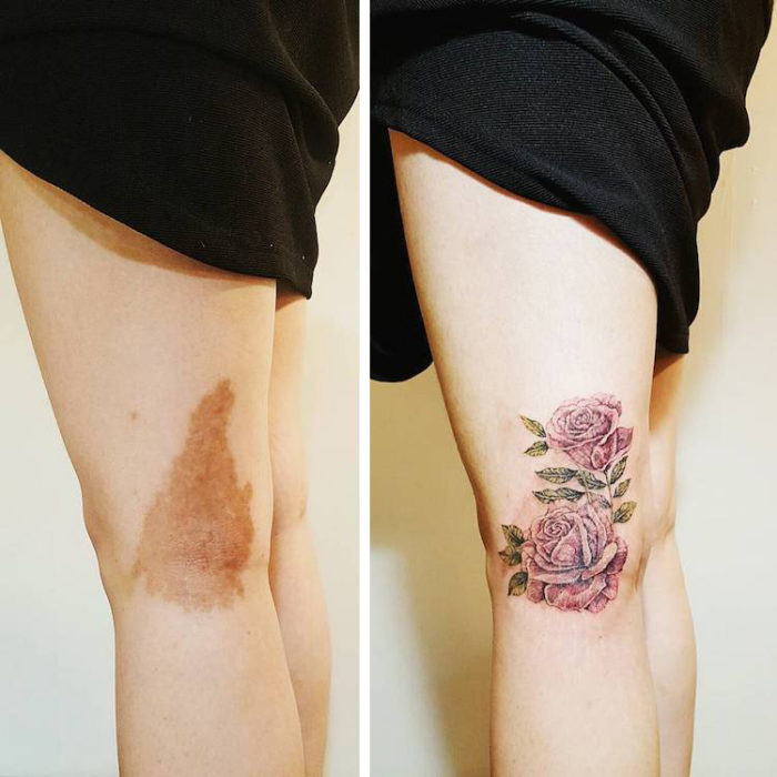 15 Creative Tattoo Ideas that Turn Birthmarks Into True Works of Art